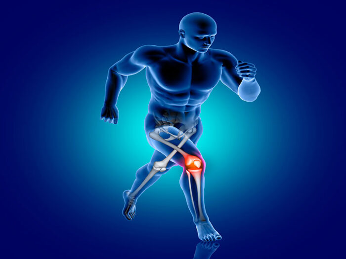 Lesión del ligamento lateral interno / Osteopatía Sevilla